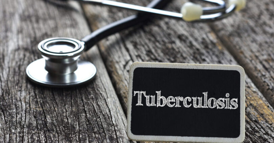 Reportan exposición a tuberculosis en escuela preparatoria de Chula ...